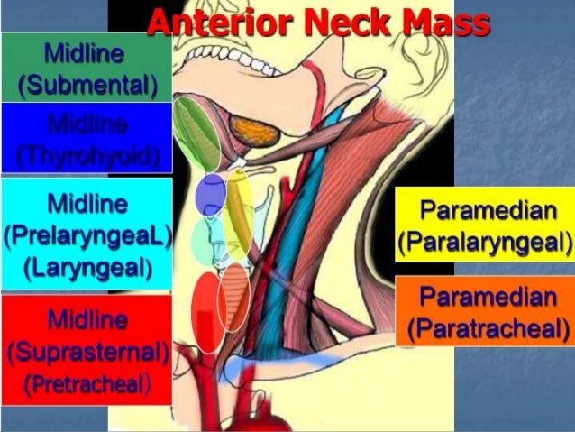 Presentation1.pptx, radiological imaging of adult neck masses.