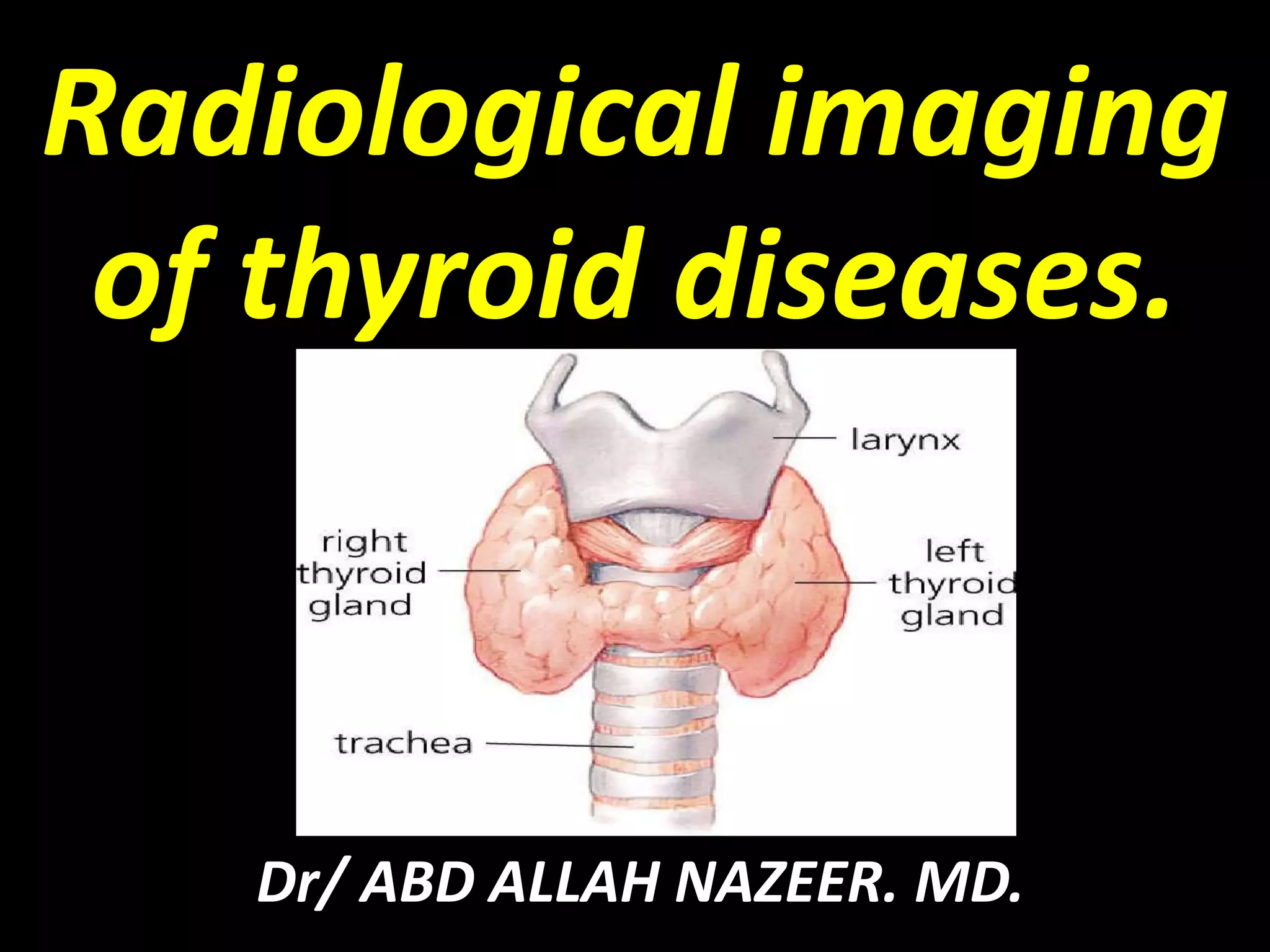 Presentation1.pptx, radiological imaging of the thyroid gland diseases ...