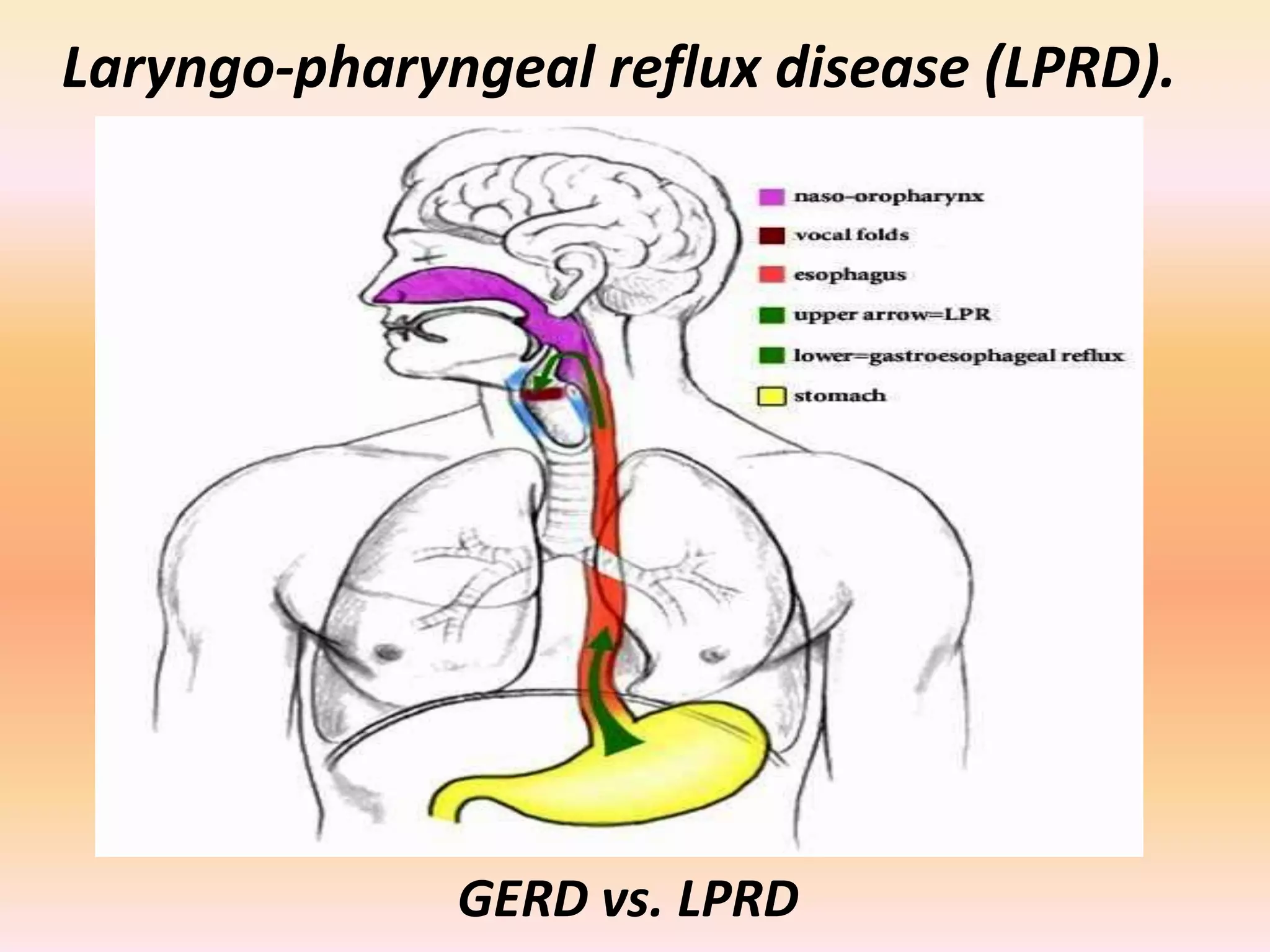 Presentation1.pptx, radiological imaging of the larngeal diseases. | PPTX