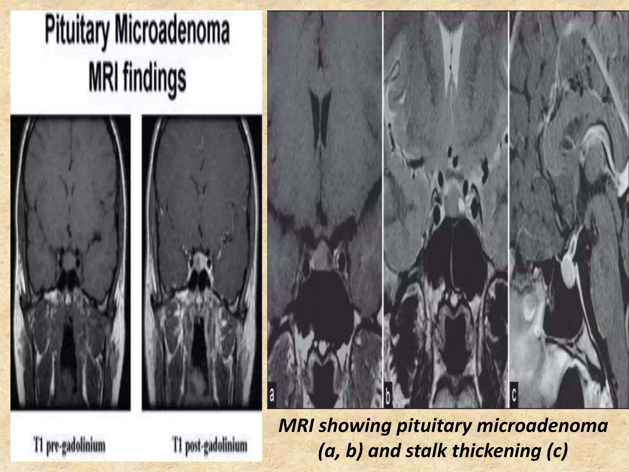 Presentation1.pptx, radiological imaging of male infertility. | PPTX