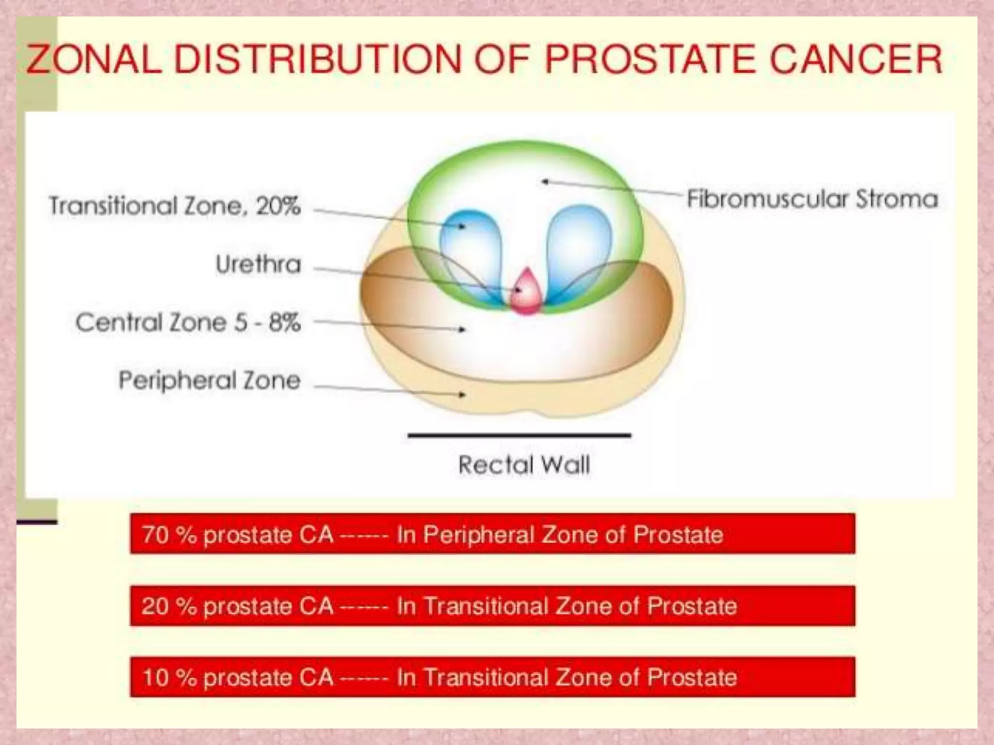 Presentation1.pptx, radiological imaging of prostatic diseases | PPTX