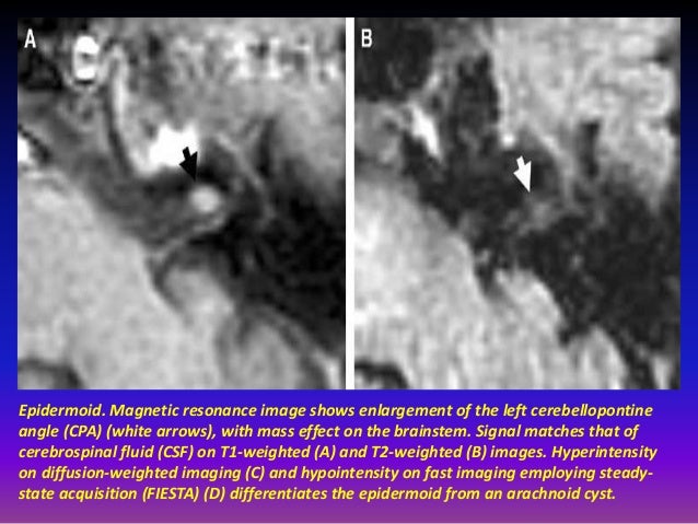 Presentation1.pptx, radiological imaging of inner ear diseases