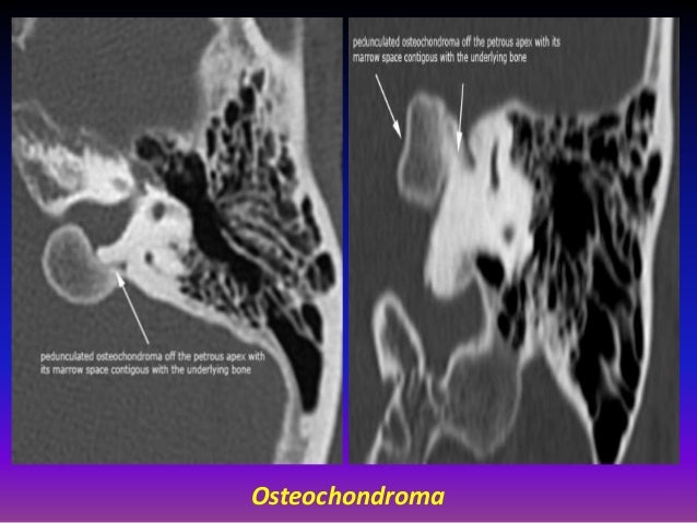 Presentation1.pptx, radiological imaging of inner ear diseases