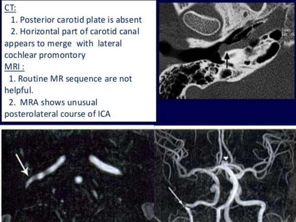Presentation1.pptx, radiological imaging of inner ear diseases