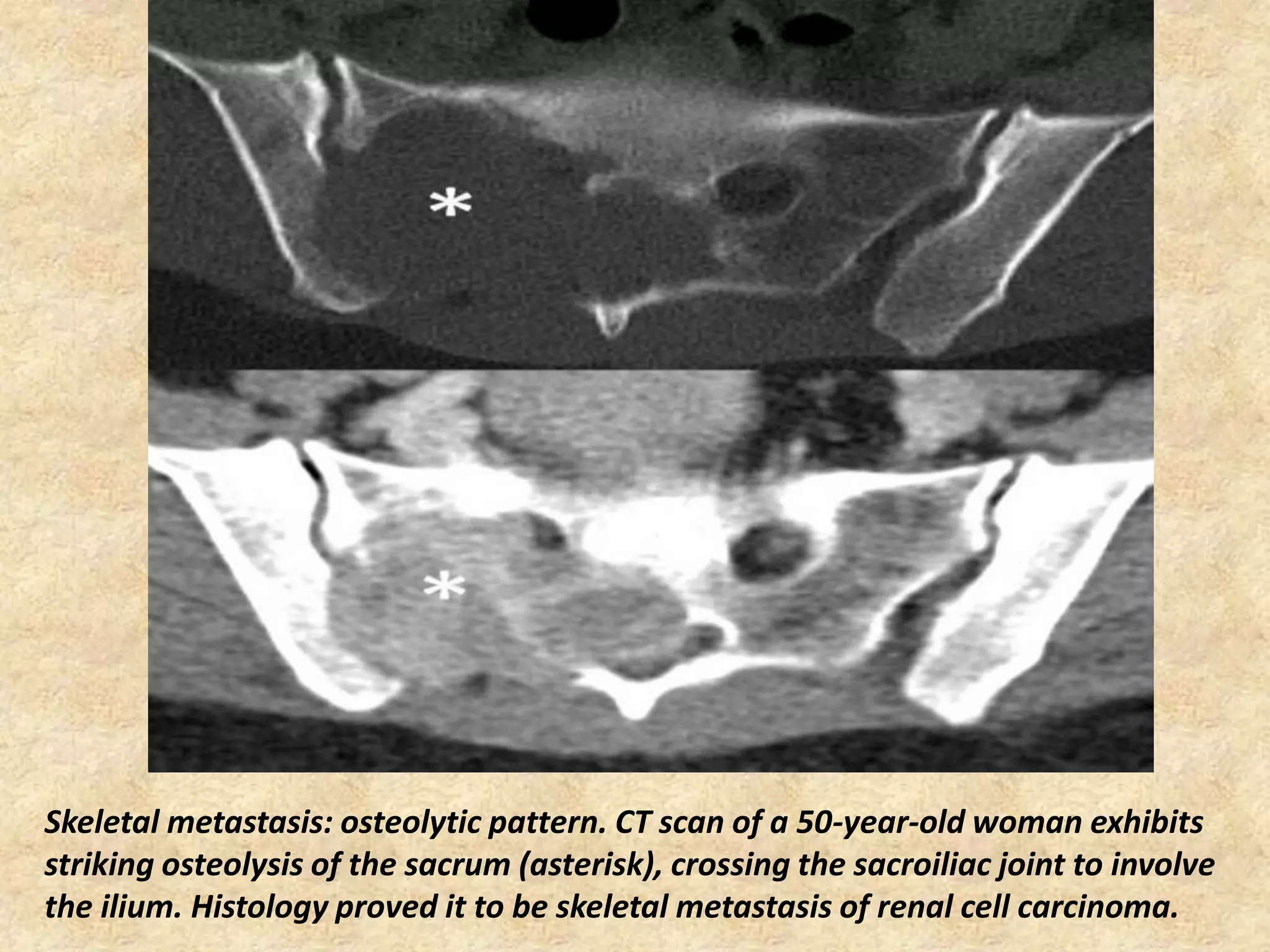 Presentation1.pptx, radiological imaging of sacroiliac joint diseases ...