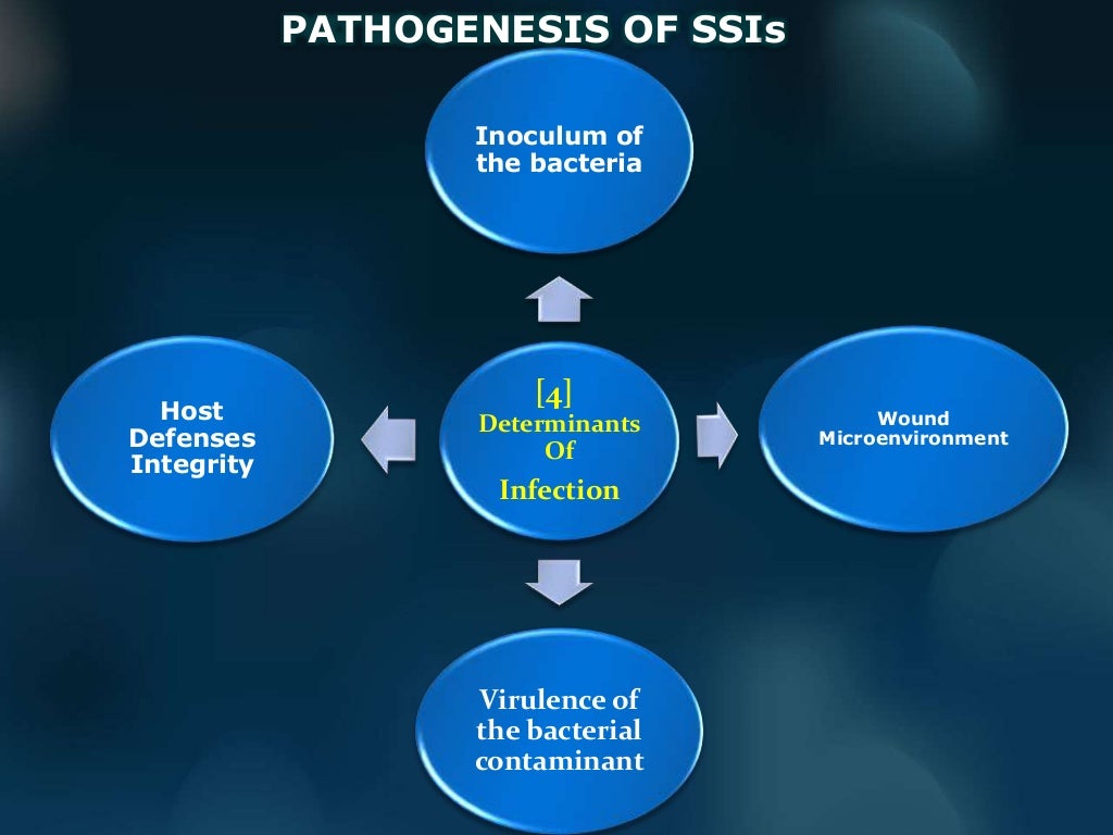 surgical site infection