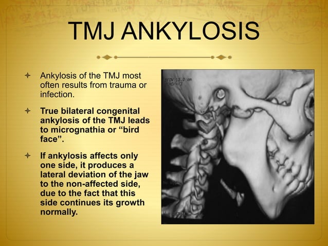 TMJ and its relation to periodontics | PPTX | Geology | Science