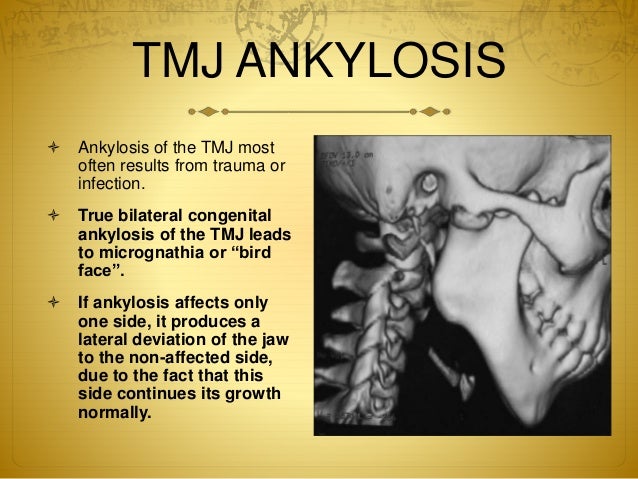 TMJ and its relation to periodontics
