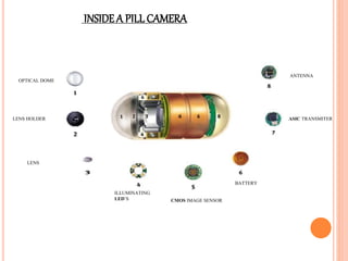 PILLCAM/PILL ENDOSCOPY | PPTX