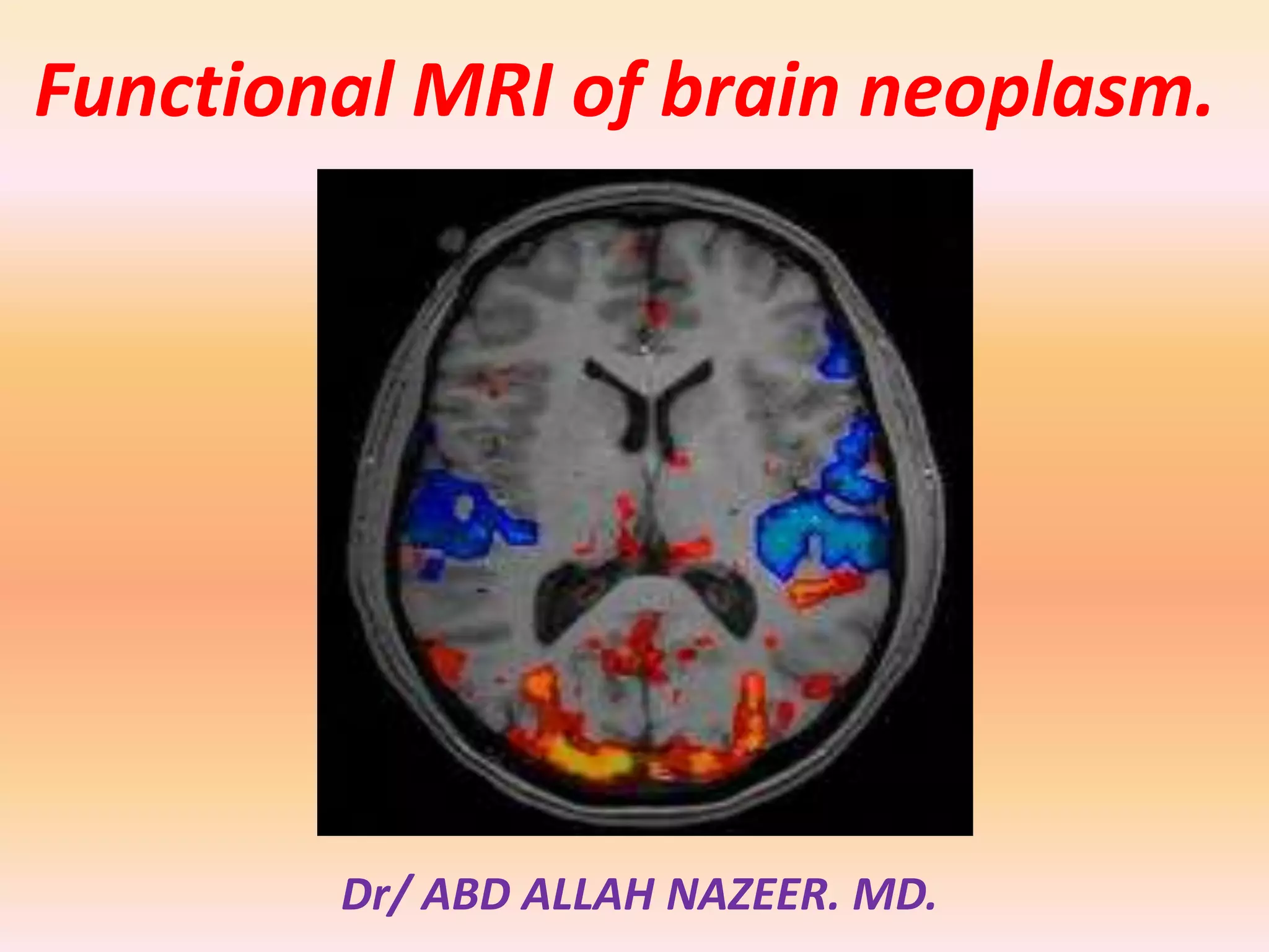 Presentation1.pptx, f mri of brain neoplasm | PPTX | Brain and Nervous ...