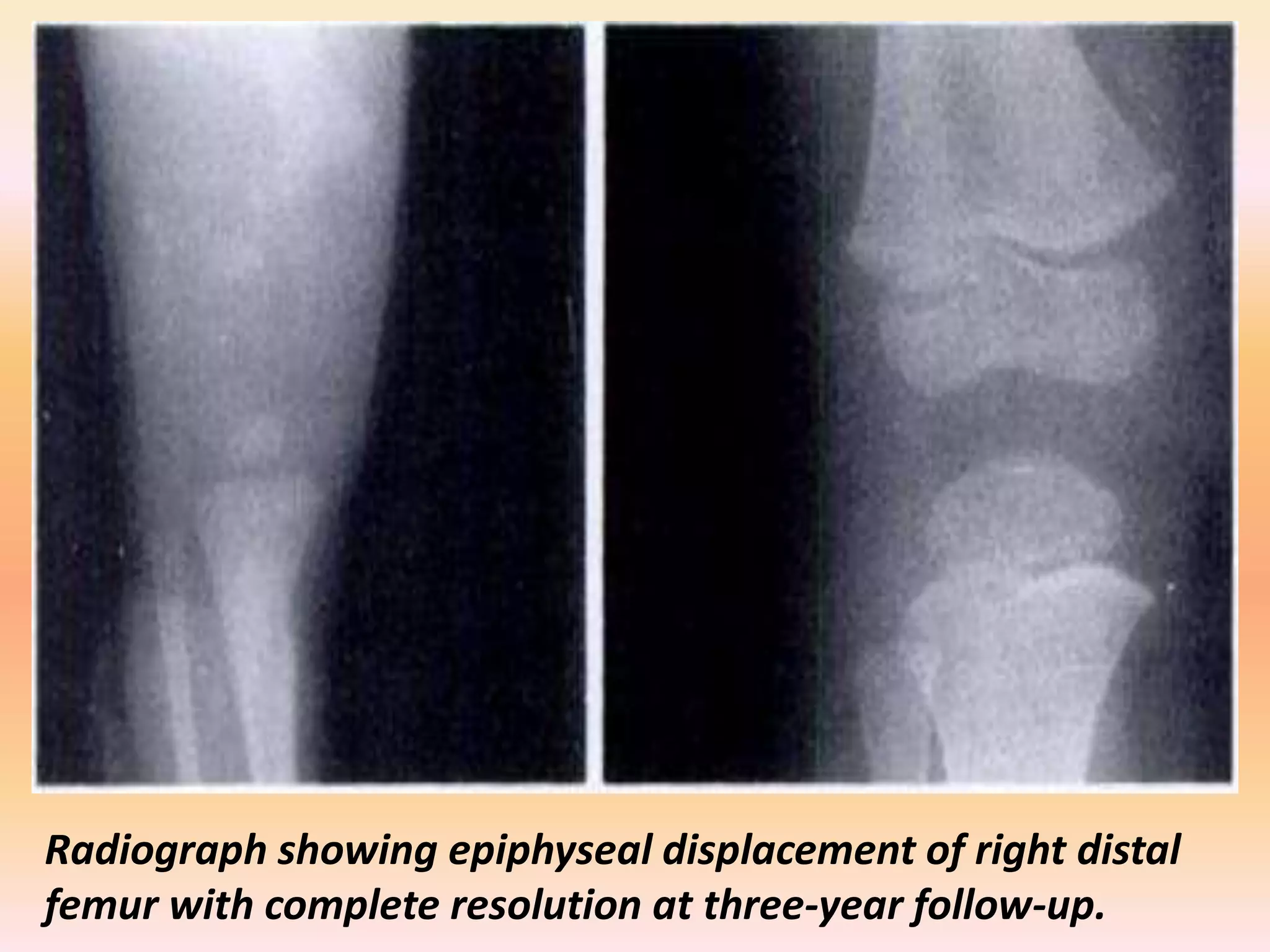 Presentation1.pptx, radiological imaging of syphilis. | PPTX ...