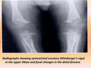 Presentation1.pptx, radiological imaging of syphilis. | PPTX