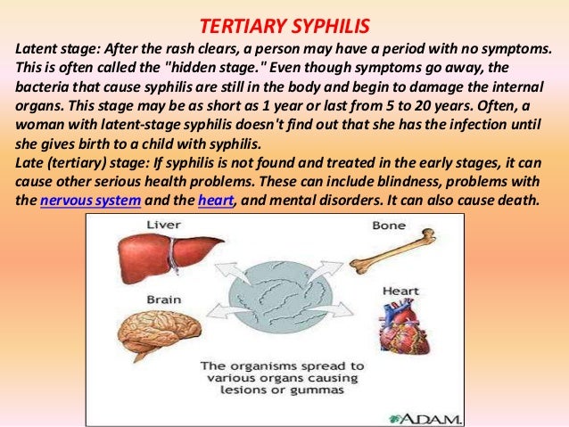 Presentation1.pptx, radiological imaging of syphilis.