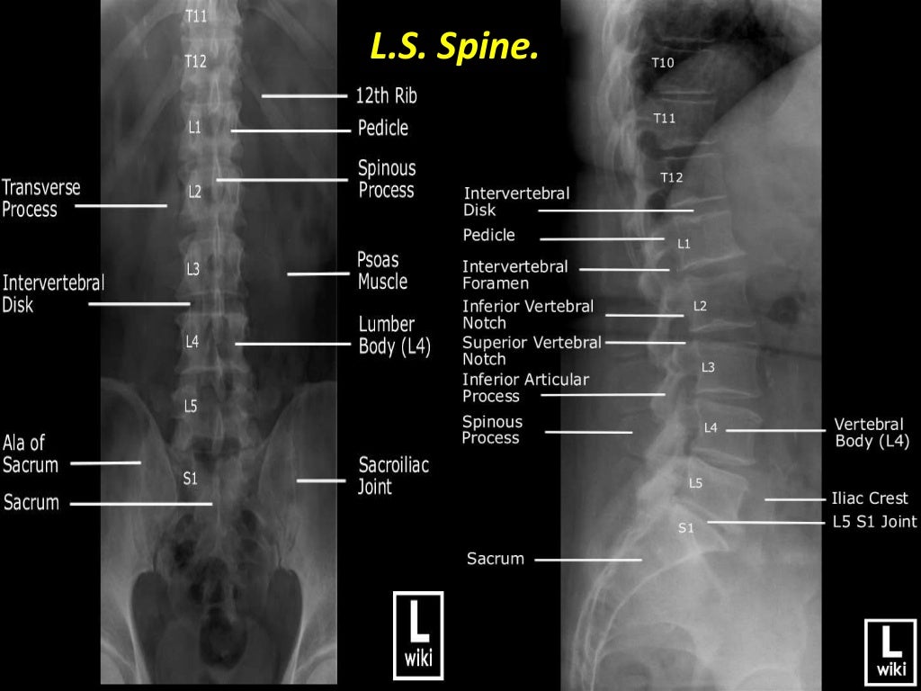 Presentation1.pptx, normal spinal anatomy.