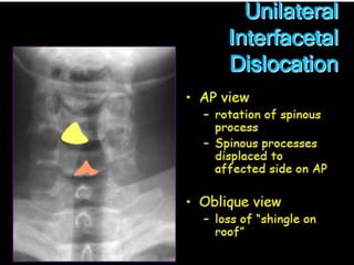 Presentation1.pptx, radiological imaging of spinal trauma and spinal ...