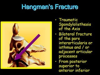 Presentation1.pptx, radiological imaging of spinal trauma and spinal ...