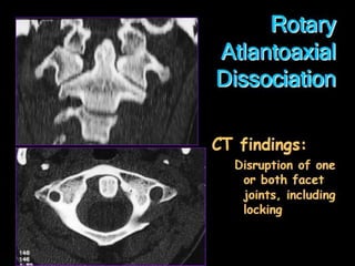 Presentation1.pptx, radiological imaging of spinal trauma and spinal ...