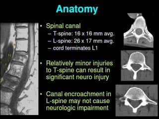 Presentation1.pptx, radiological imaging of spinal trauma and spinal ...