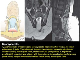 Presentation1.pptx, radiological imaging of congenital anomalies of the ...