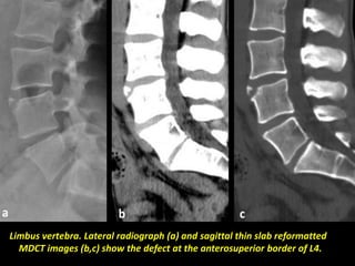 Presentation1.pptx, radiological imaging of congenital anomalies of the ...