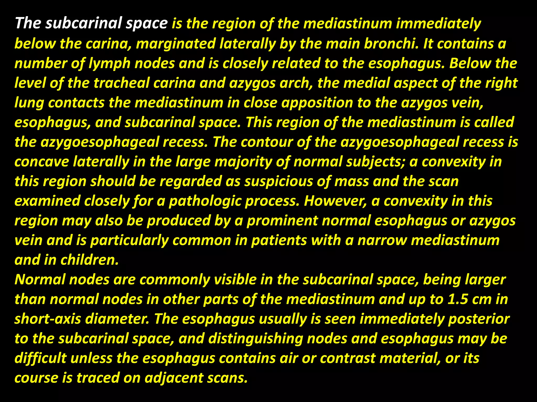 Presentation1.pptx, radiological anatomy of the chest. | PPTX