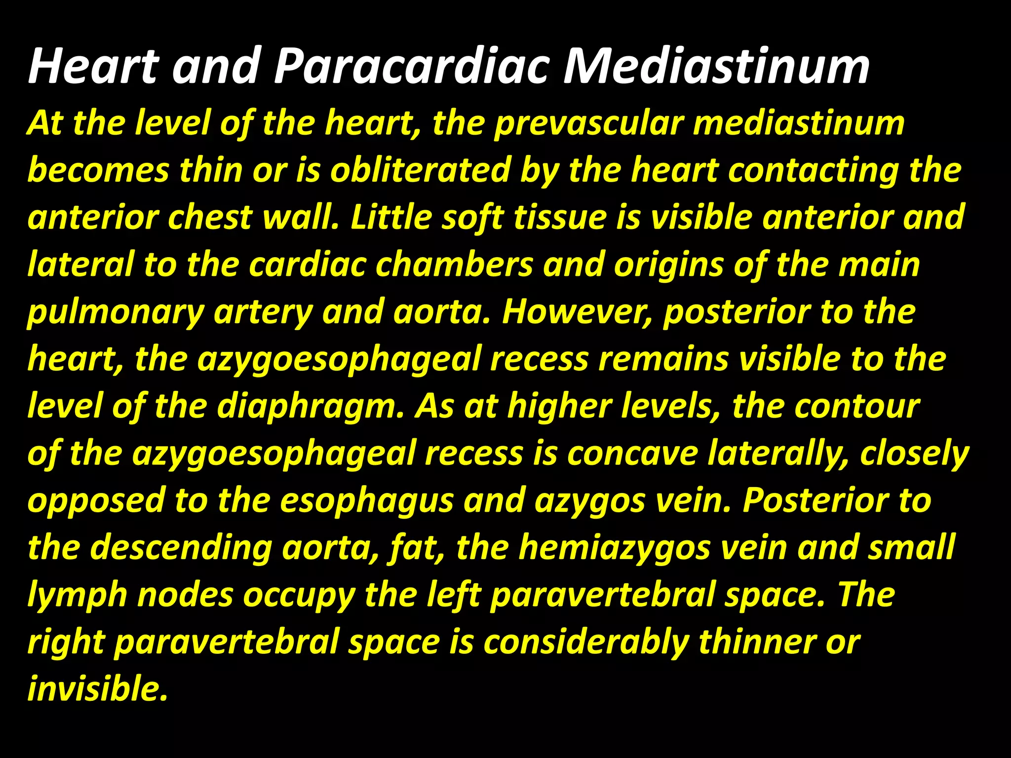 Presentation1.pptx, radiological anatomy of the chest. | PPTX