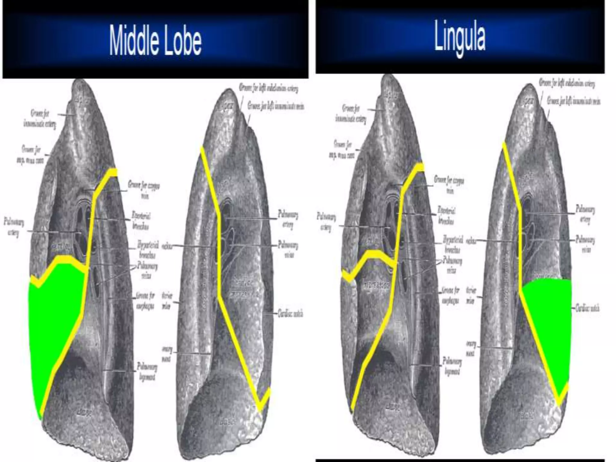 Presentation1.pptx, radiological anatomy of the chest. | PPTX