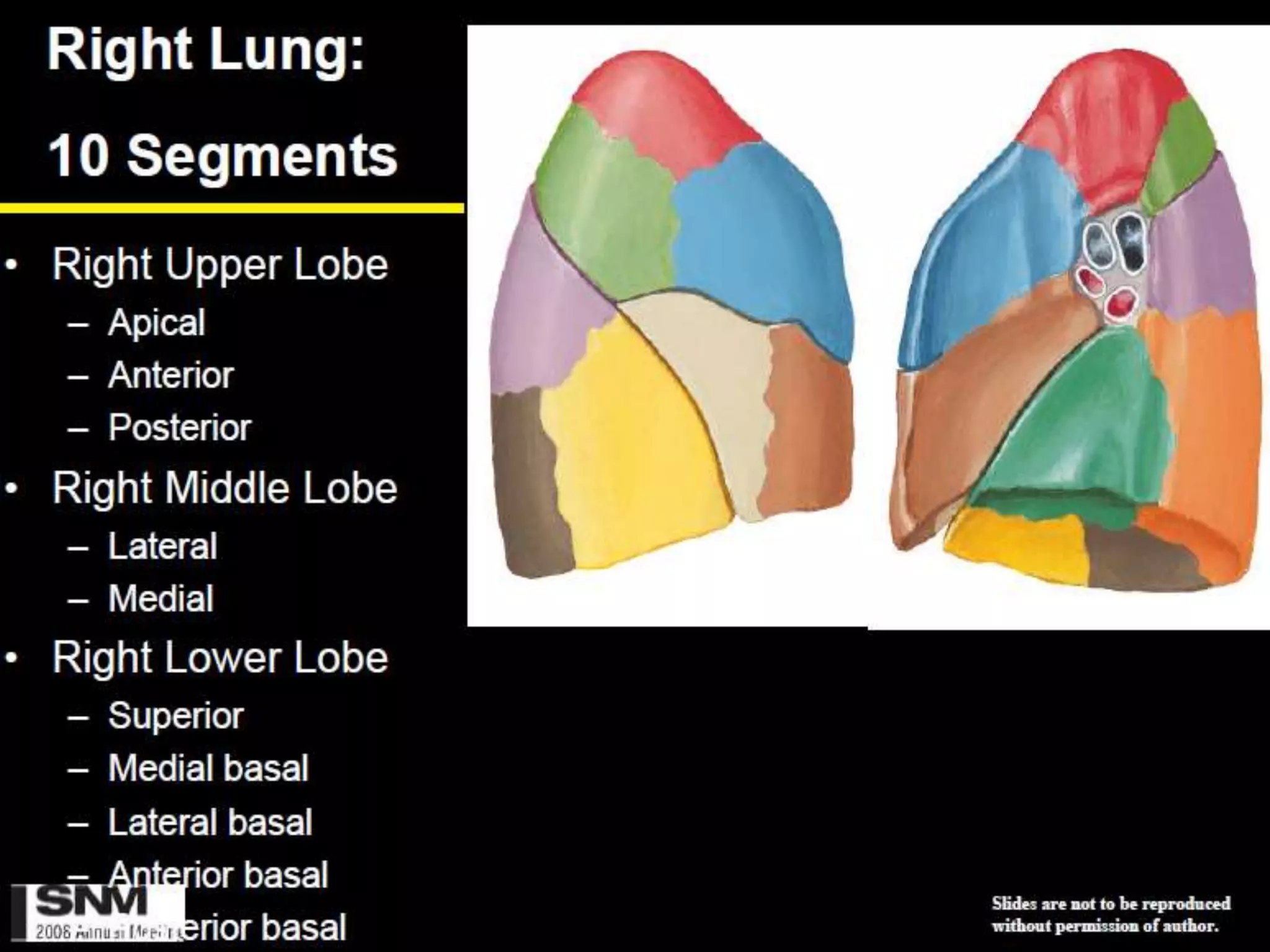 Presentation1.pptx, radiological anatomy of the chest. | PPTX