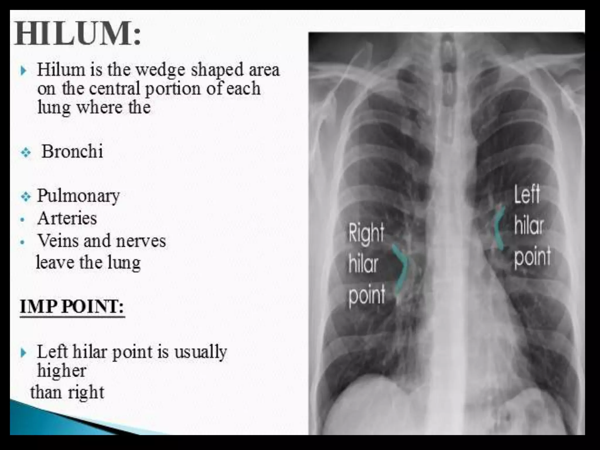 Presentation1.pptx, radiological anatomy of the chest. | PPTX