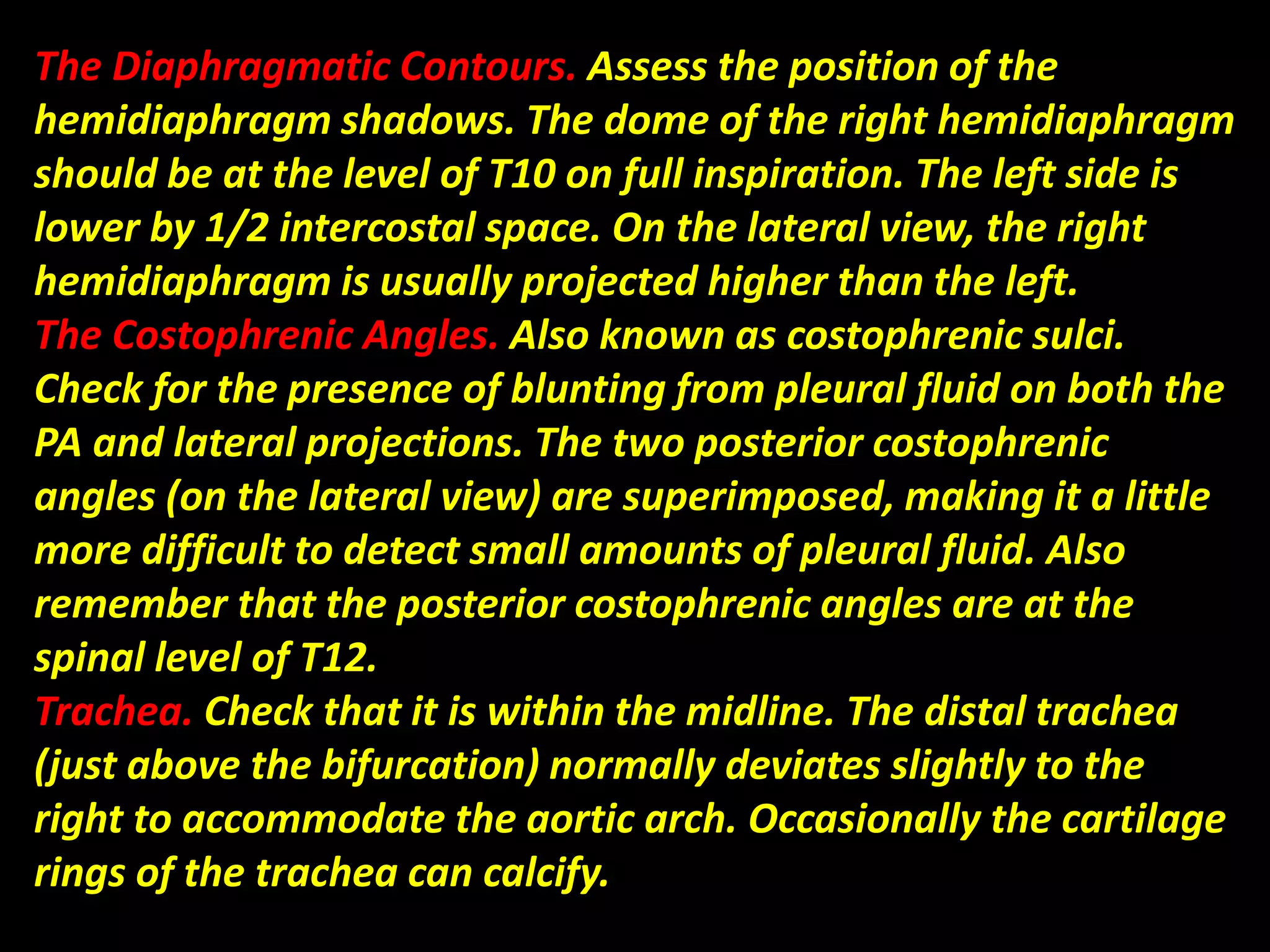 Presentation1.pptx, radiological anatomy of the chest. | PPTX