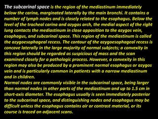 Presentation1.pptx, radiological anatomy of the chest. | PPTX