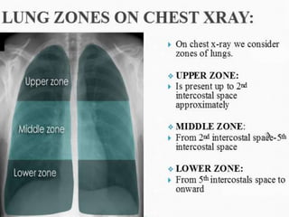 Presentation1.pptx, radiological anatomy of the chest. | PPTX