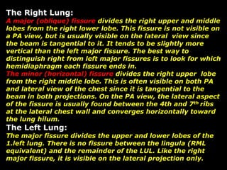 Presentation1.pptx, radiological anatomy of the chest. | PPTX
