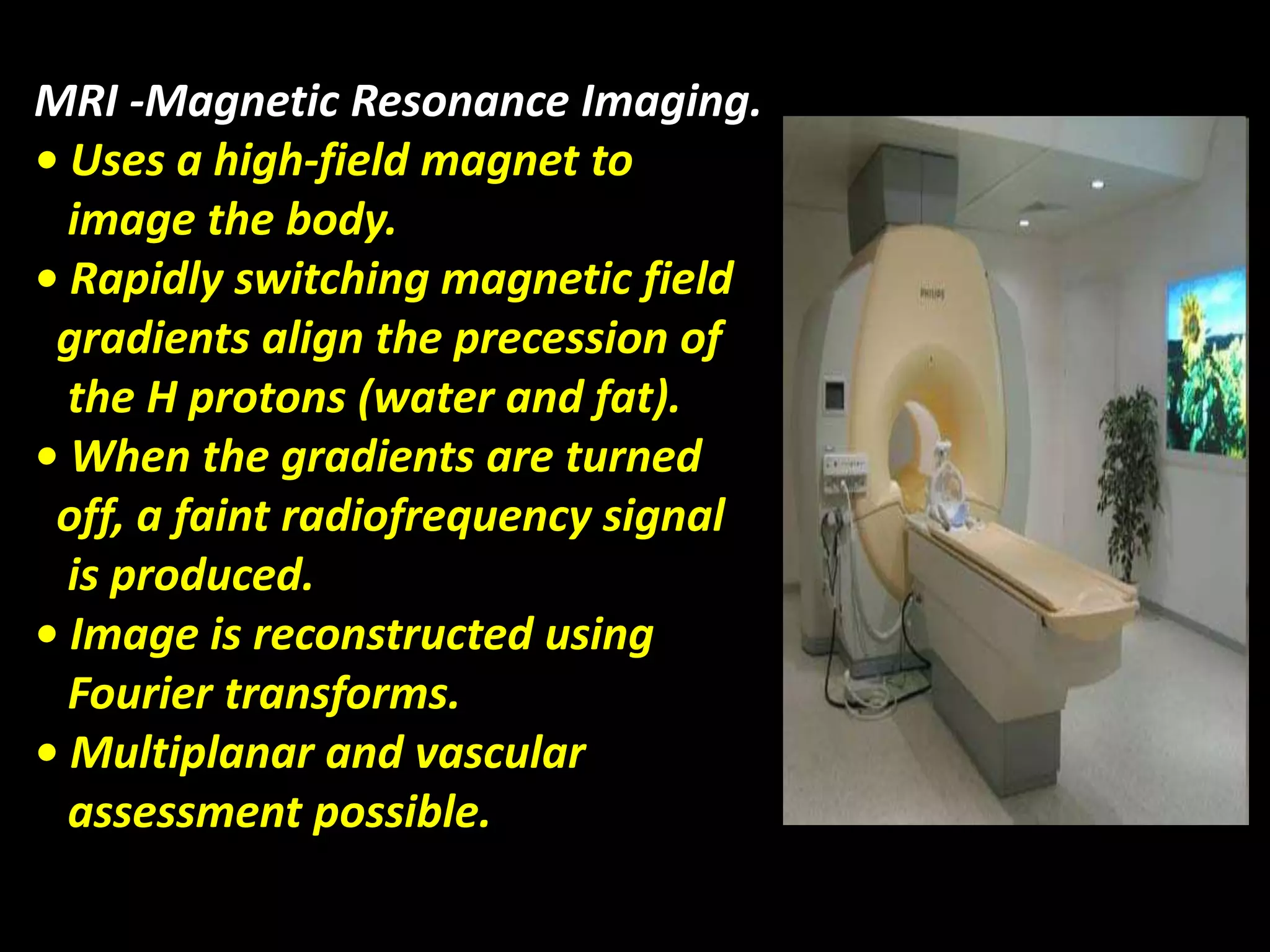 Presentation1.pptx, radiological anatomy of the abdomen and pelvis. | PPTX