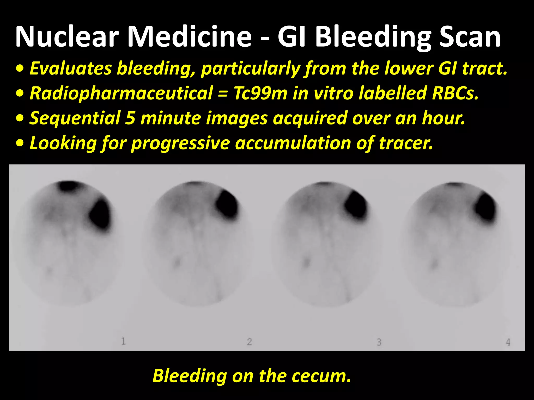 Presentation1.pptx, radiological anatomy of the abdomen and pelvis. | PPTX
