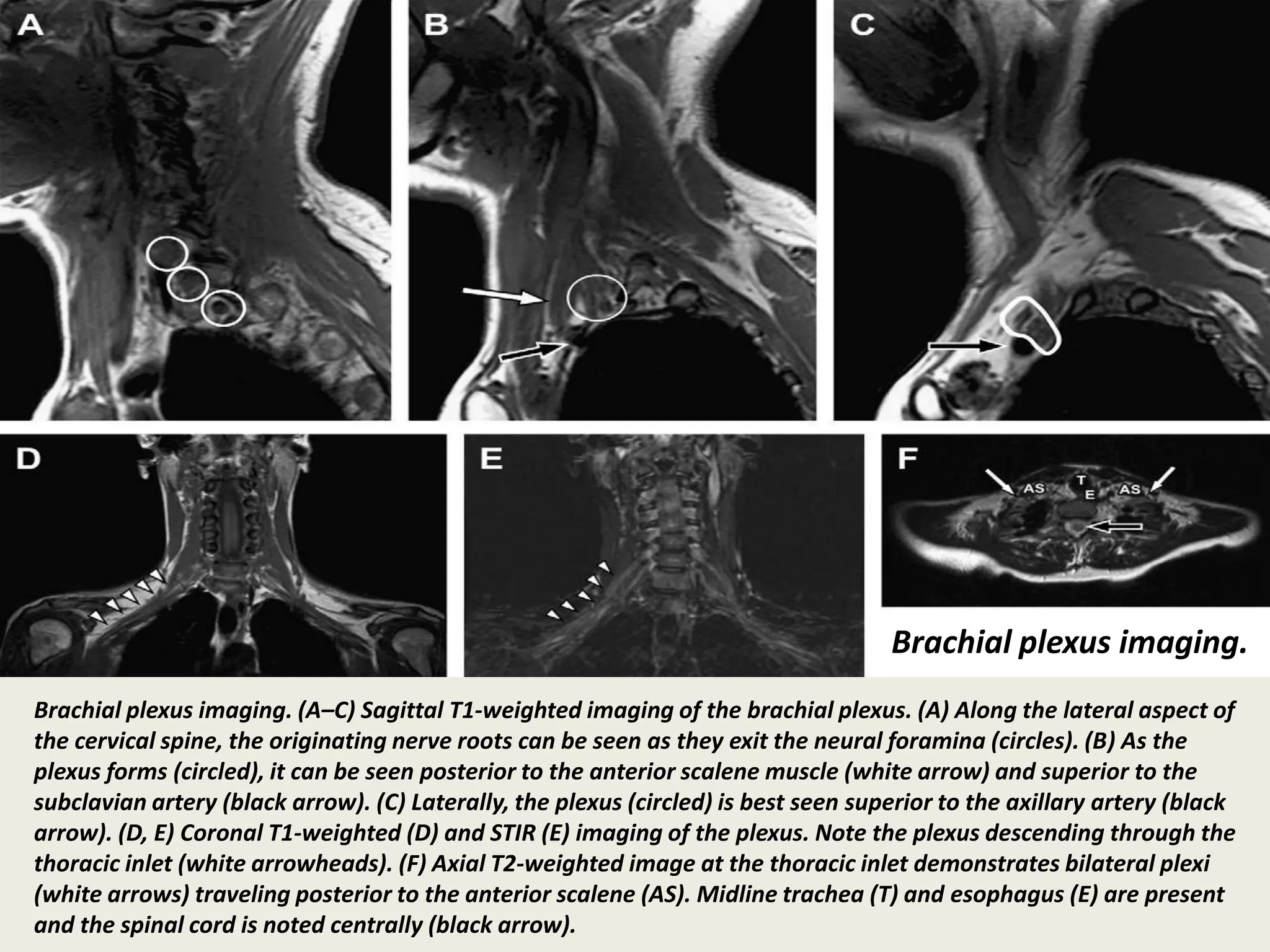 Presentation1.pptx, radiological anatomy of the neck. | PPTX