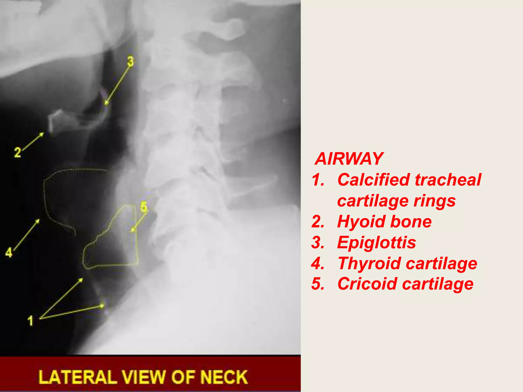 Presentation1.pptx, radiological anatomy of the neck. | PPTX