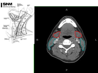 Presentation1.pptx, radiological anatomy of the neck. | PPTX