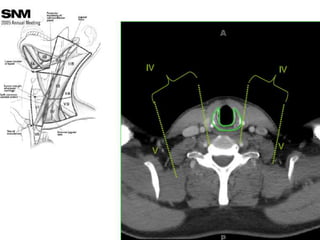 Presentation1.pptx, radiological anatomy of the neck. | PPTX