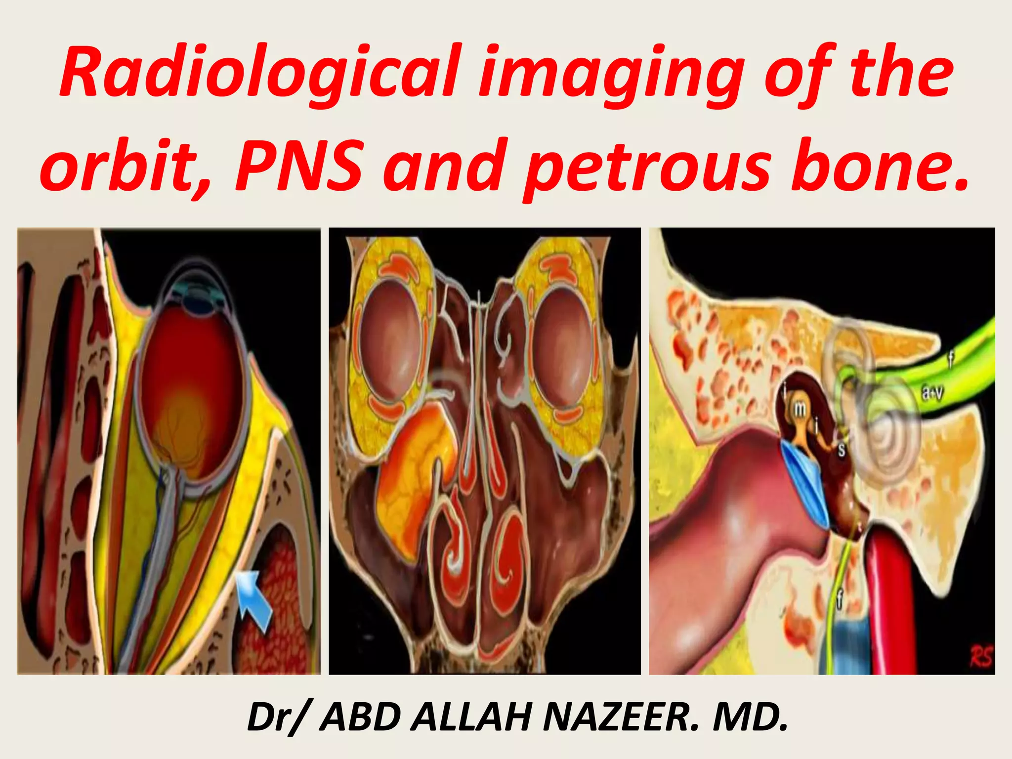 Presentation1.pptx, radiological anatomy of the orbits, pns and petrous ...