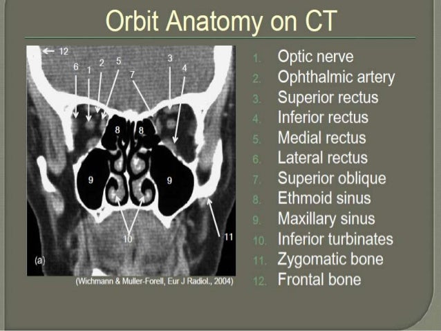 Orbit Imaging Anatomy