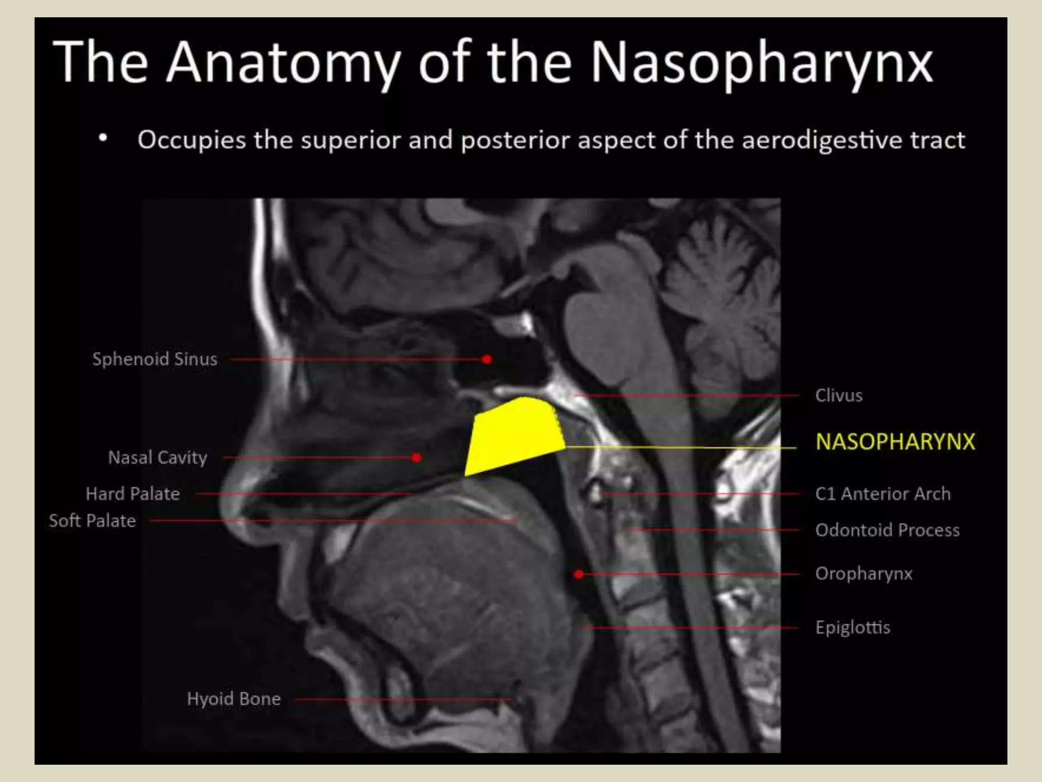 Presentation1.pptx, radiological anatomy of the naso, oro and ...