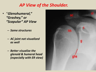 Presentation1.pptx, radiological anatomy of the upper limb joint. | PPTX