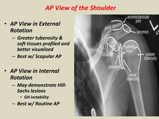 Presentation1.pptx, radiological anatomy of the upper limb joint. | PPTX