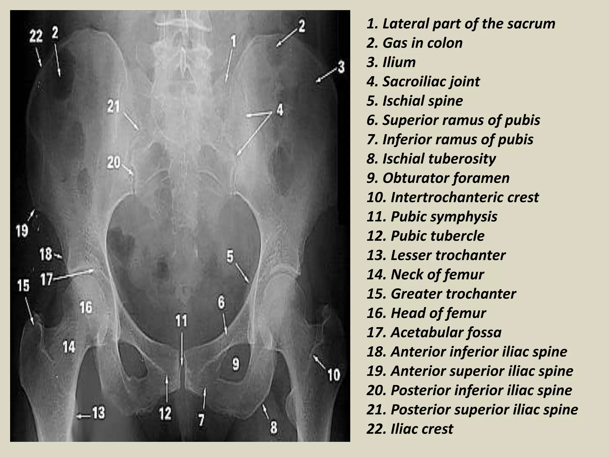 Presentation1.pptx, radiological anatomy of the lower limb anatomy. | PPTX