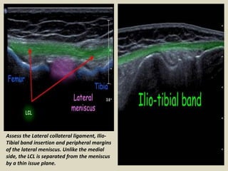Presentation1.pptx, radiological anatomy of the lower limb anatomy. | PPTX