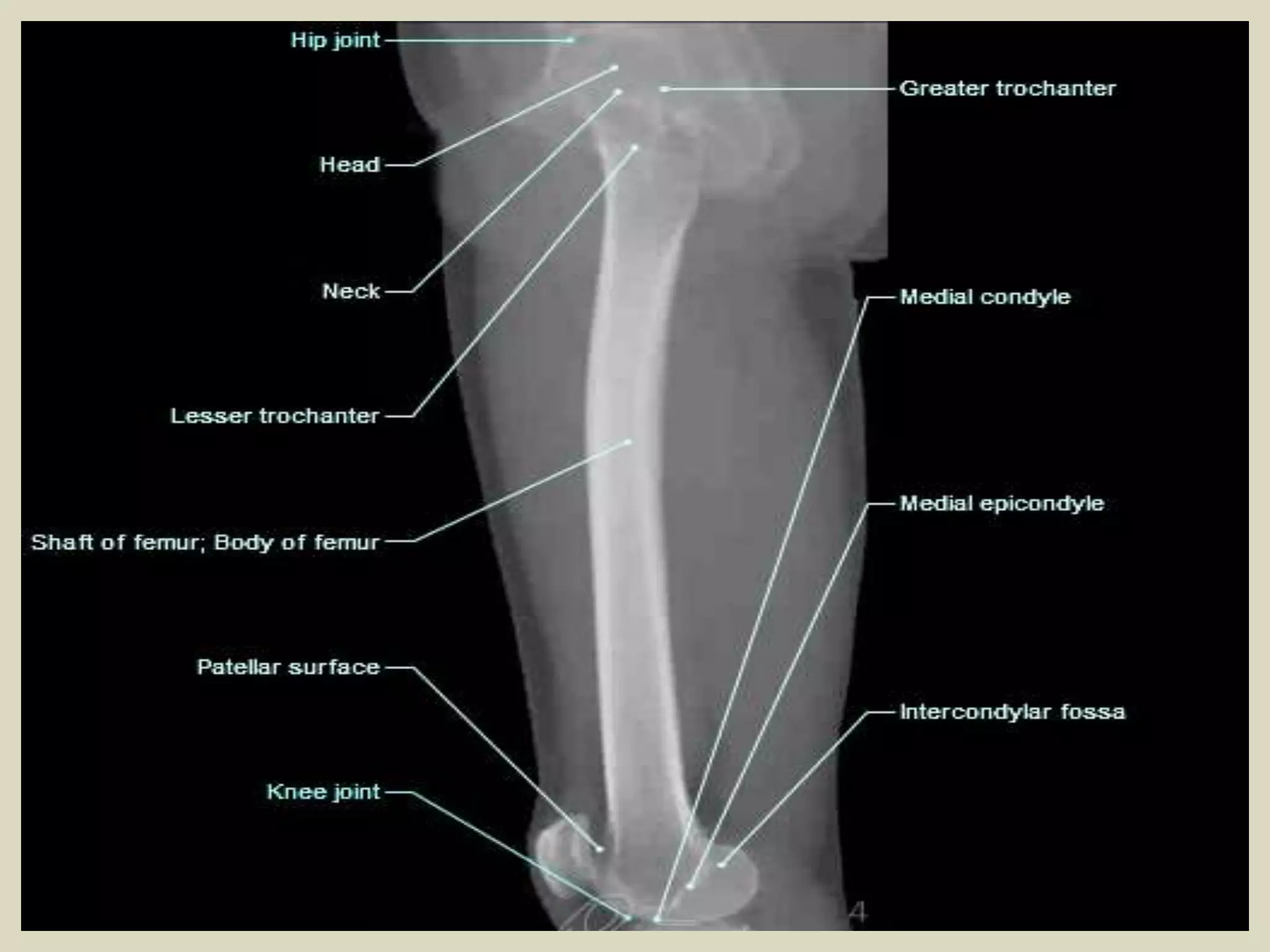 Presentation1.pptx, radiological anatomy of the thigh and leg. | PPTX