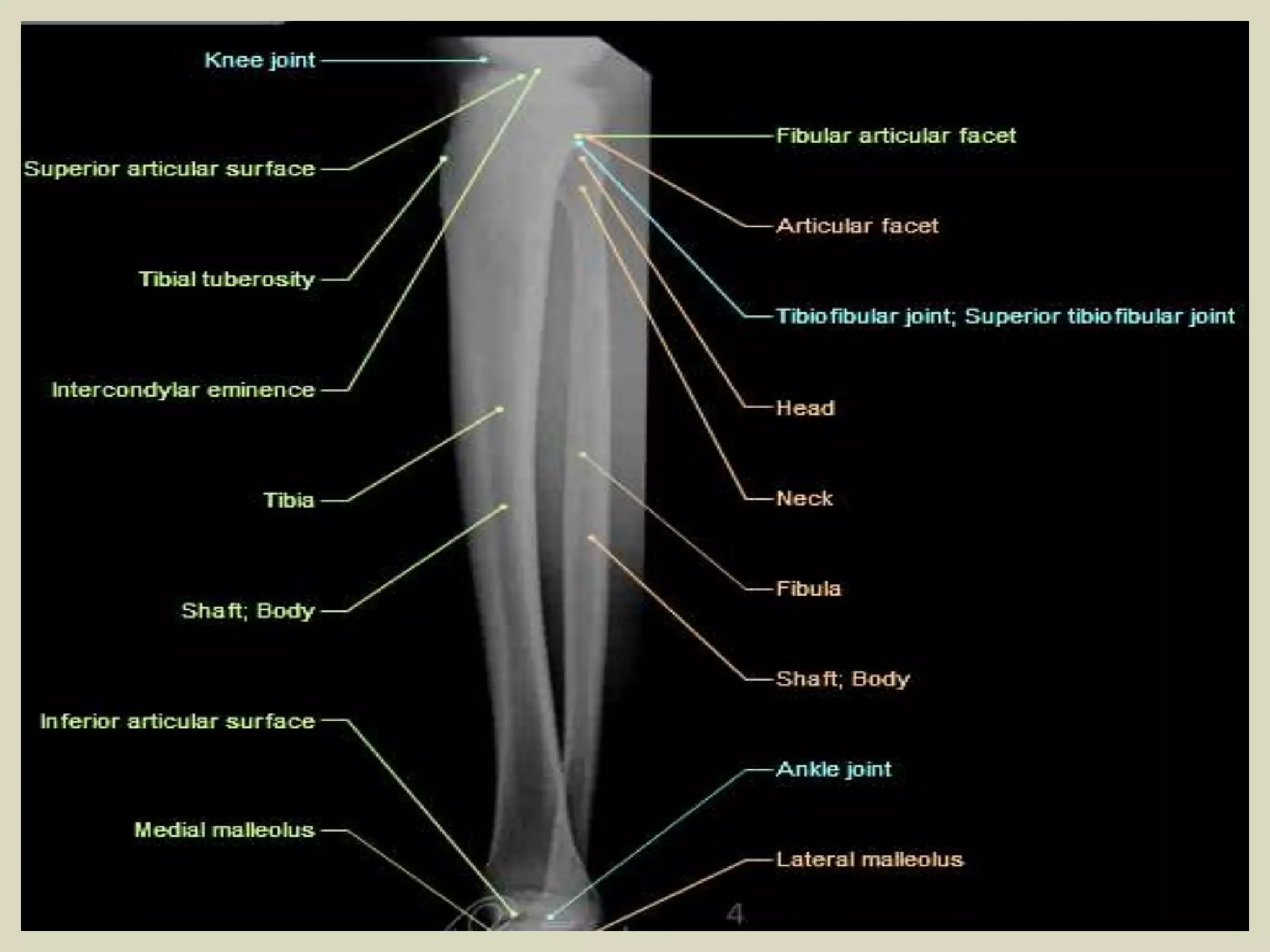 Presentation1.pptx, radiological anatomy of the thigh and leg. | PPTX
