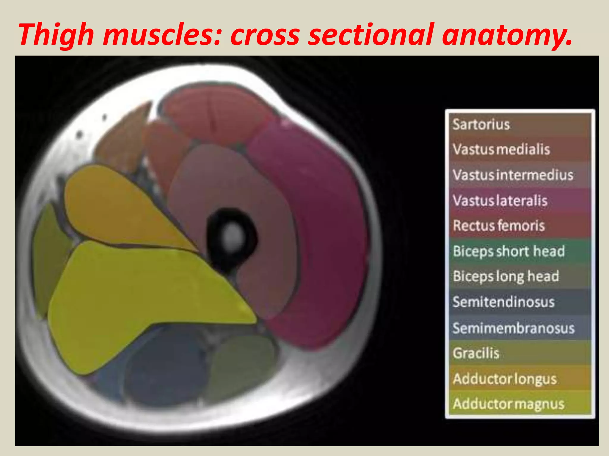 Presentation1.pptx, radiological anatomy of the thigh and leg. | PPTX