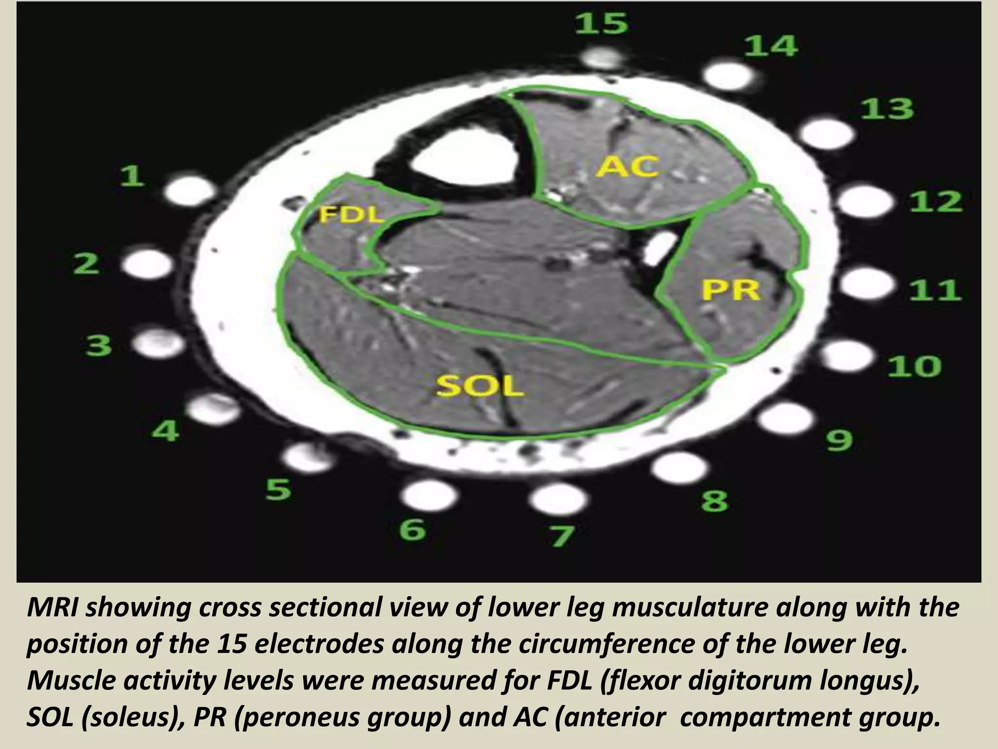 Presentation1.pptx, radiological anatomy of the thigh and leg. | PPTX